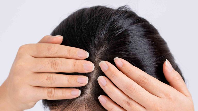 8 Ways to Increase Blood Circulation to Scalp for Great Hair